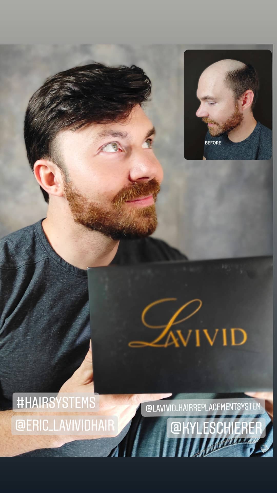 Realistic Toupee for men – Man Hair Salon
